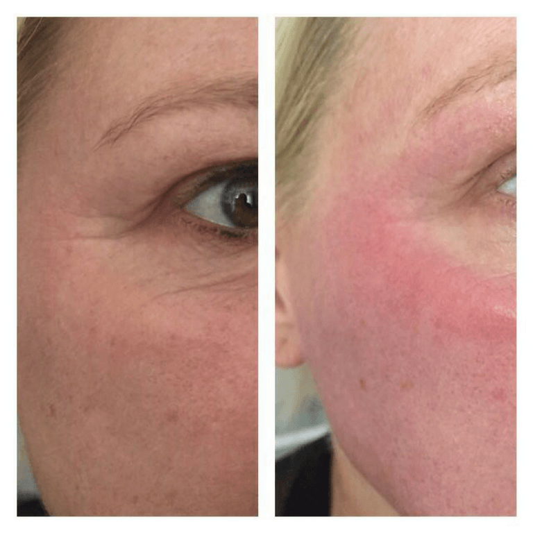 Accent Prime | LASS WAXEN